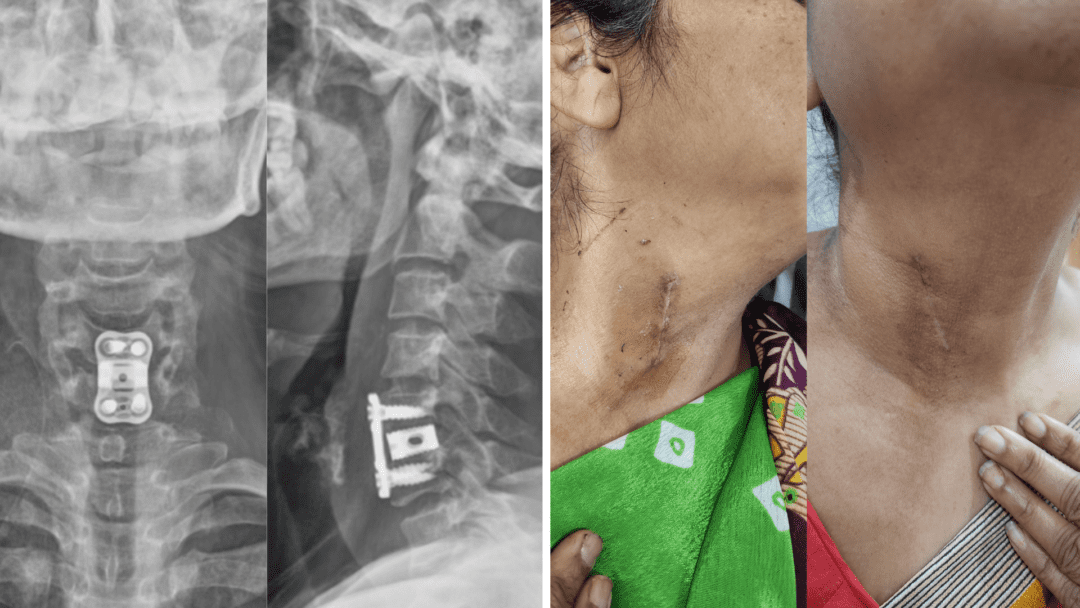 Mrs. Chaya - The Spine Doctor